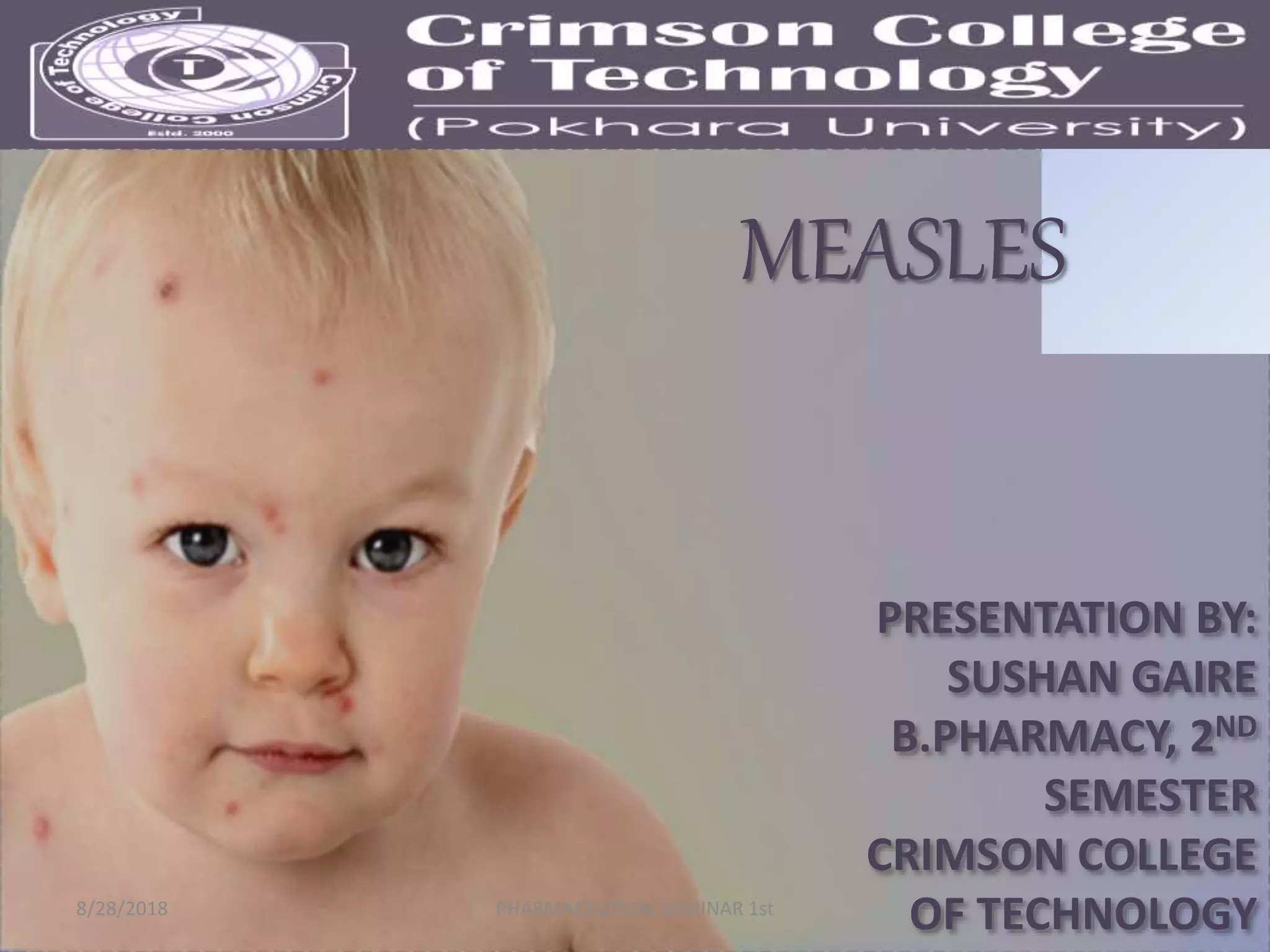 Measles | PPTX