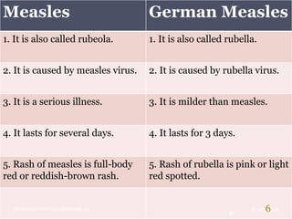 Measles | PPTX