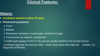 Measles made Ridiculously Easy!!!!!!!!!! | PPT