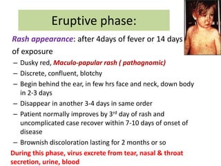Measles | PPTX | Infectious Diseases | Diseases and Conditions