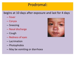 Measles | PPTX | Infectious Diseases | Diseases and Conditions