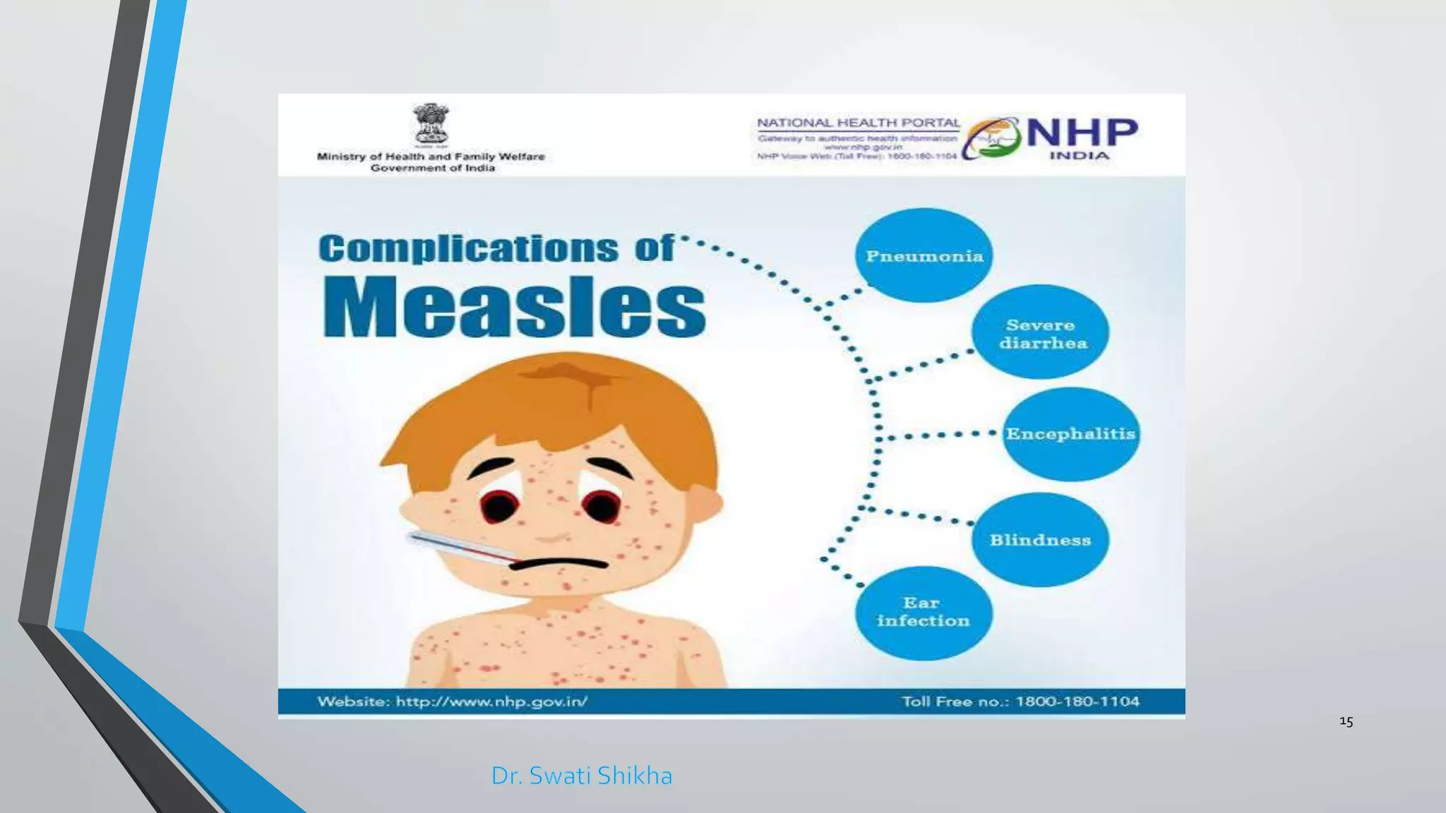 Measles | PPTX