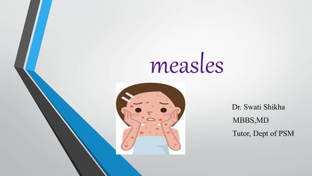 Measles | PPTX | Infectious Diseases | Diseases and Conditions