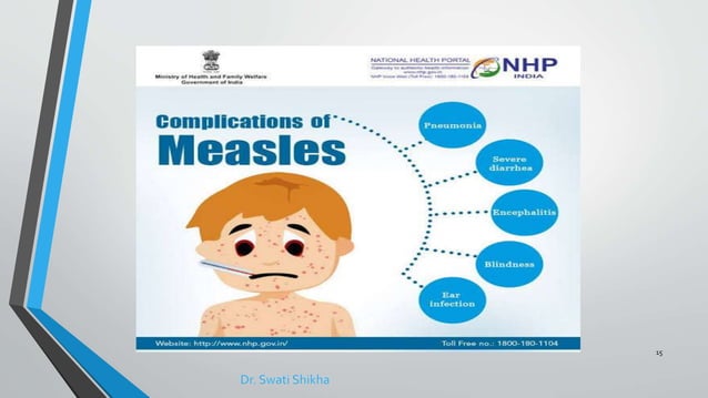 Measles | PPTX | Infectious Diseases | Diseases and Conditions