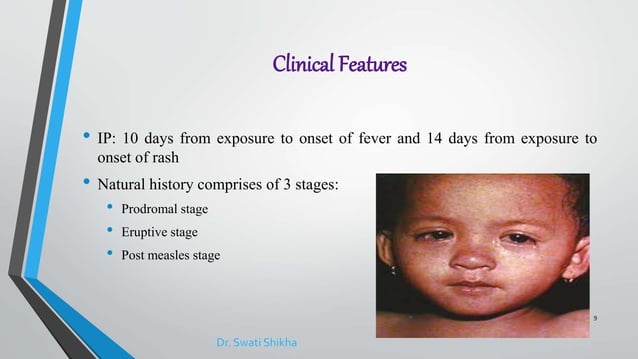 Measles | PPTX | Infectious Diseases | Diseases and Conditions