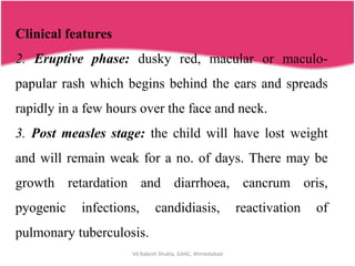 Measles | PPTX