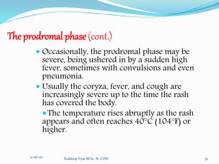 Measles | PPTX