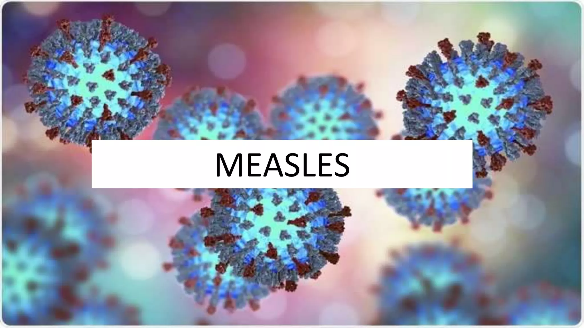 Measles | PPT
