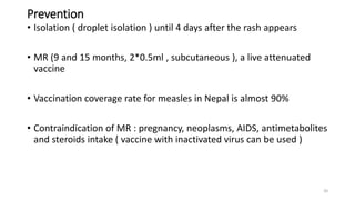 common exanthematous illness: measles | PPT