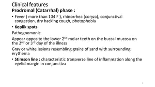 common exanthematous illness: measles | PPTX