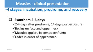 Measles in chlidren. DR.OZIL