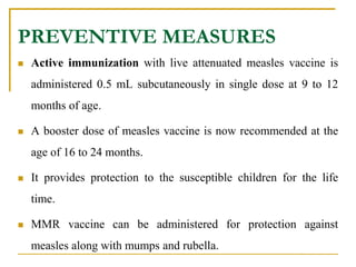 Measles Prevention And Control