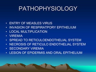 MEASLES.ppt