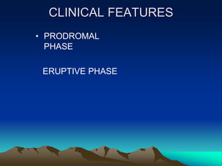 MEASLES.ppt