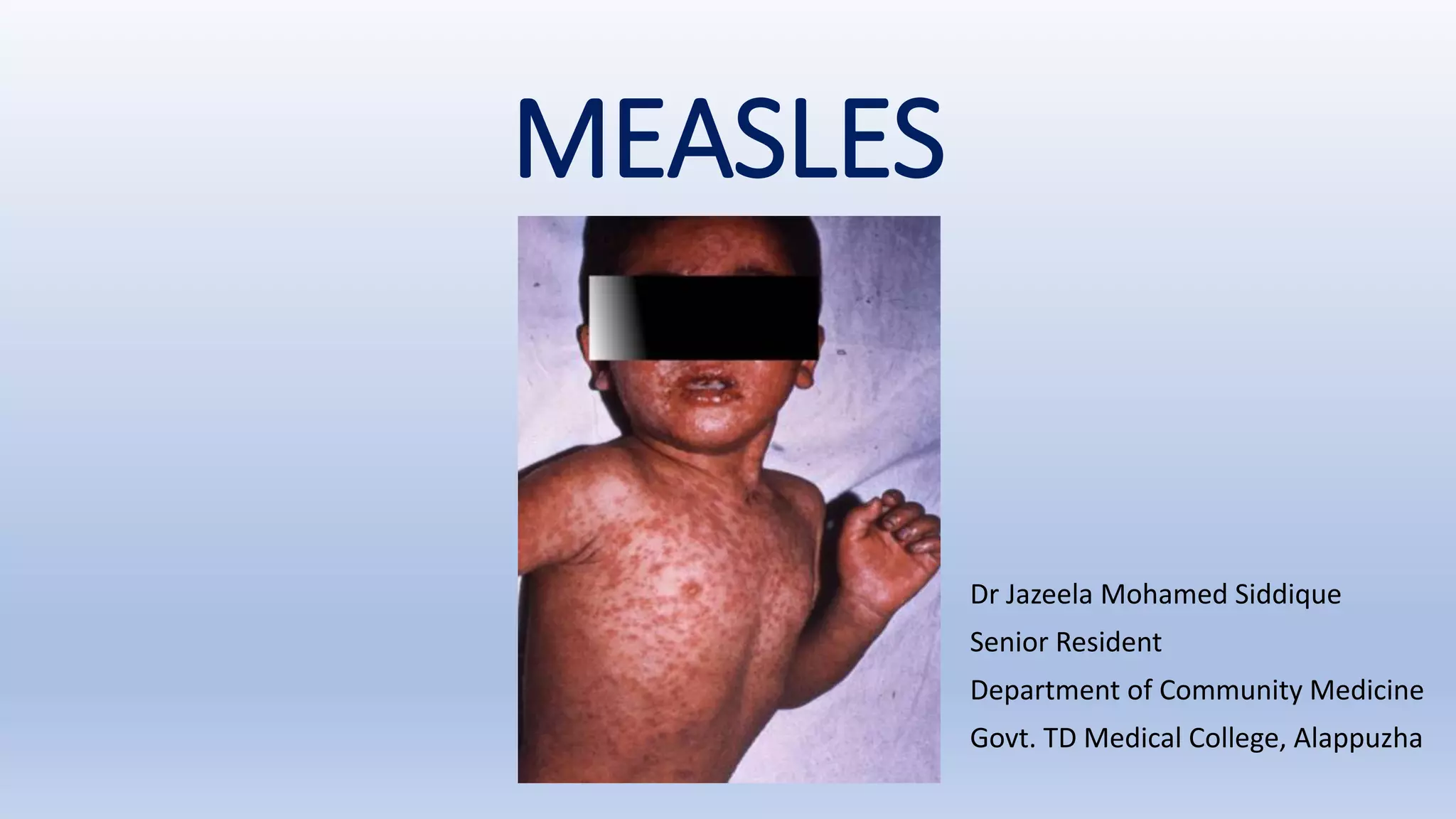 MEASLES.pptx