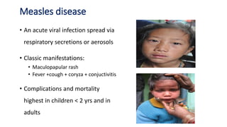 MEASLES.pptx