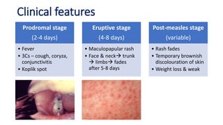 MEASLES.pptx
