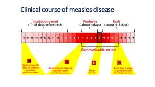 MEASLES.pptx