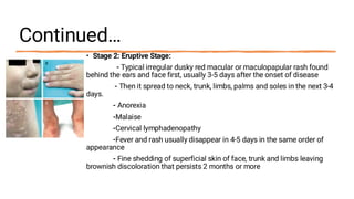 measles.pdf | Infectious Diseases | Diseases and Conditions
