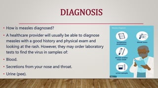 Measles Department of Physiotherapy, SHUATS, Prayagraj | PPT