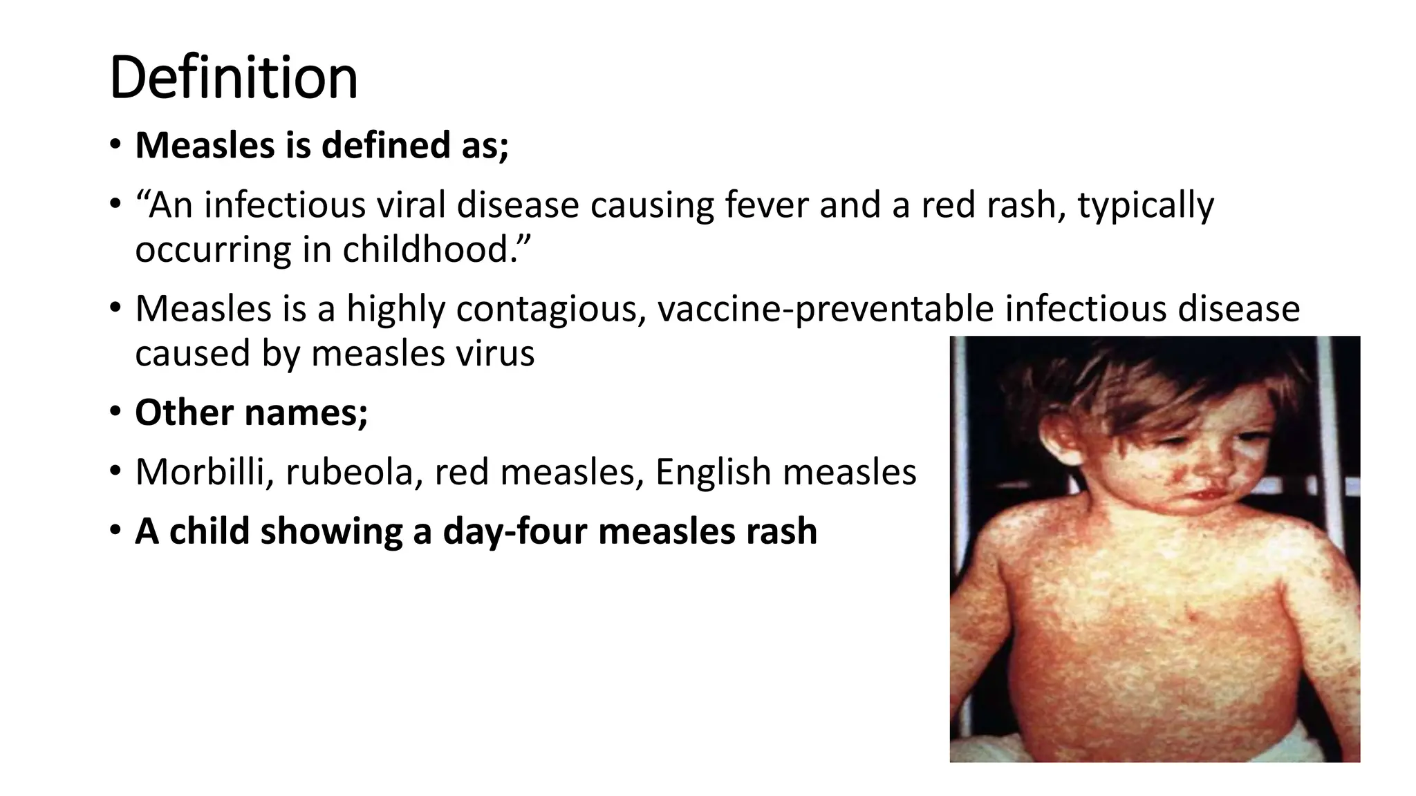 Measles definition , causes, sign and symptoms.pptx