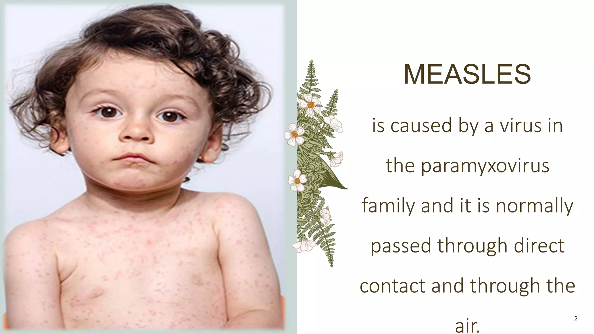 MEASLES-CHN-REP..pptx