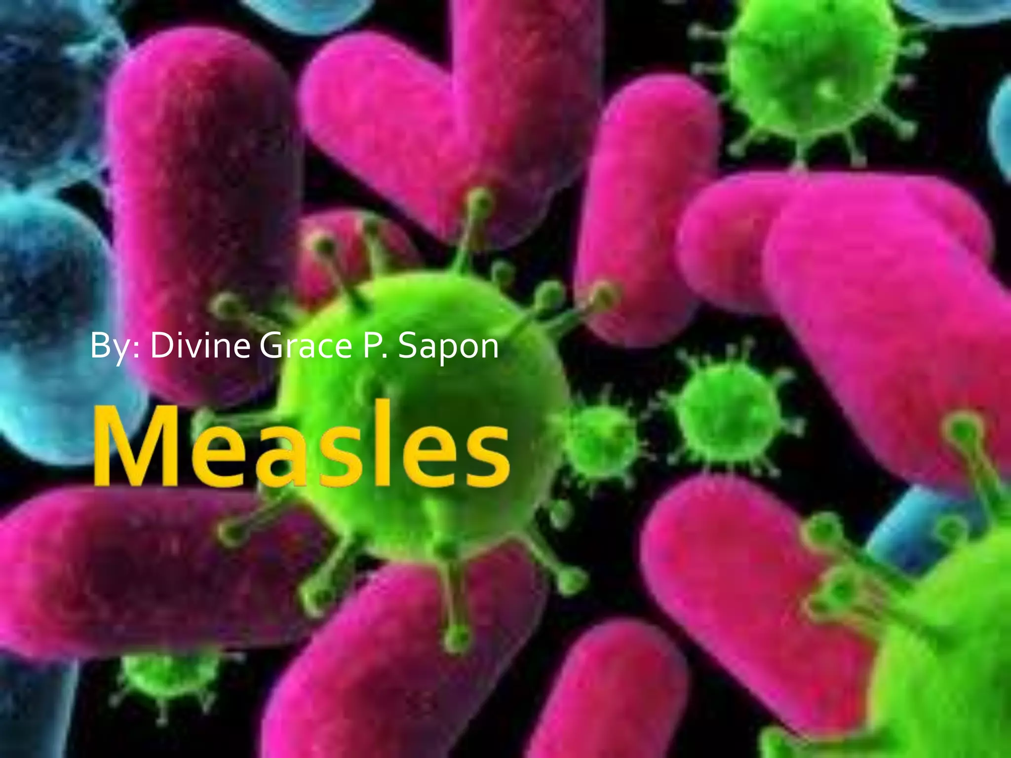 Measles | PPTX