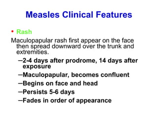 Measles (1).pptAAAAAAAAAAAAAAAAAAAAAAAAA | PPT