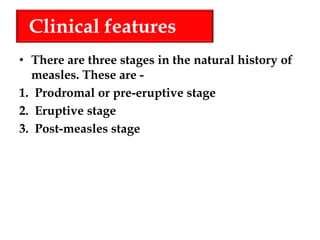 Measles | PDF