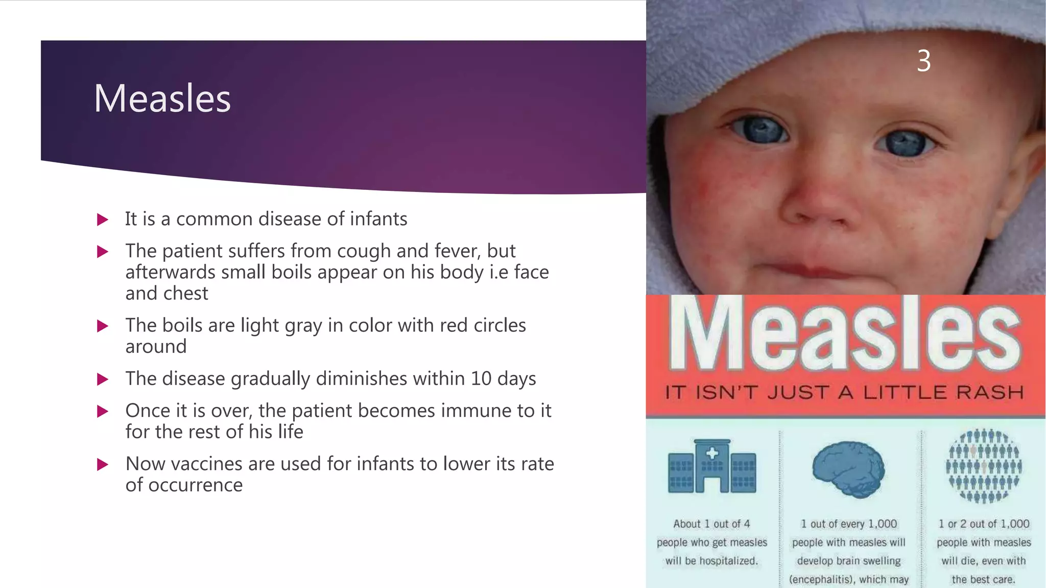 Measles, aids, hepatitus | PPT