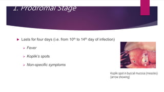 measles and parvovirus ppt.pptx