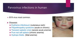 measles and parvovirus ppt.pptx