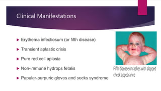 measles and parvovirus ppt.pptx