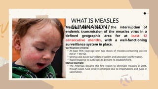MEASLES ELIMINATION program 2025 .pptx