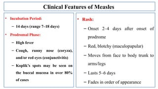 Measles Epidemiology and Surveillance 2022.pptx