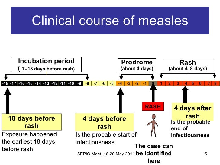 Measles surveillance sepio mtg 18 20 may 2011 (ab) v1