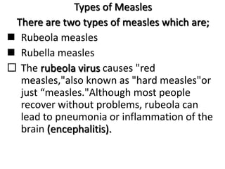 MEASLES Group one Presentation.pptx