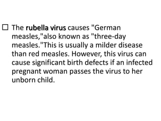 MEASLES Group one Presentation.pptx