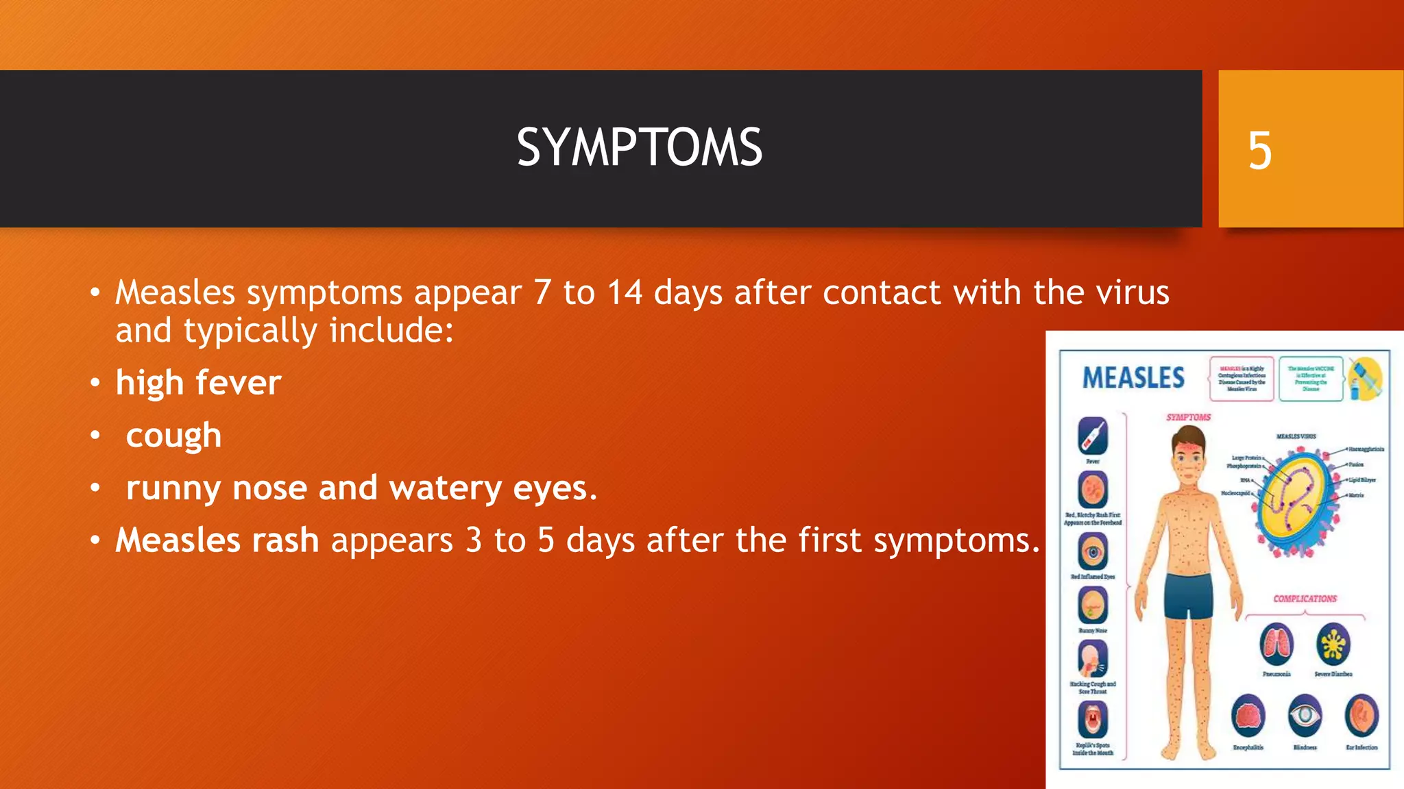 Measles in Pediatrics.pptx