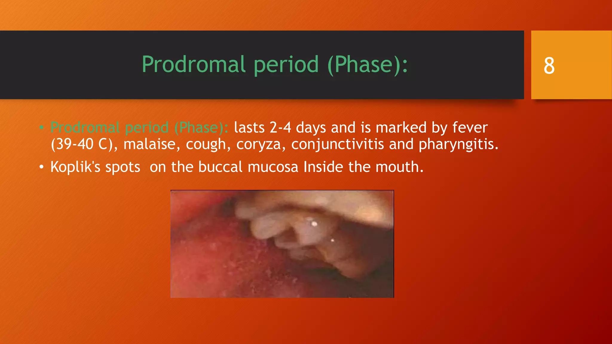Measles in Pediatrics.pptx
