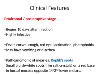 Powerpoint on MEASLES, MUMPS & RUBELLA.pptx