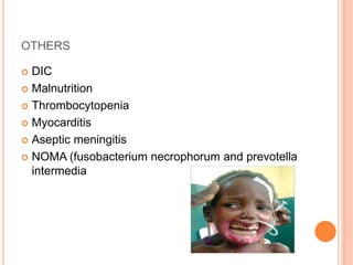 Management of measles. | PPTX