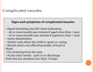 Management of measles. | PPTX