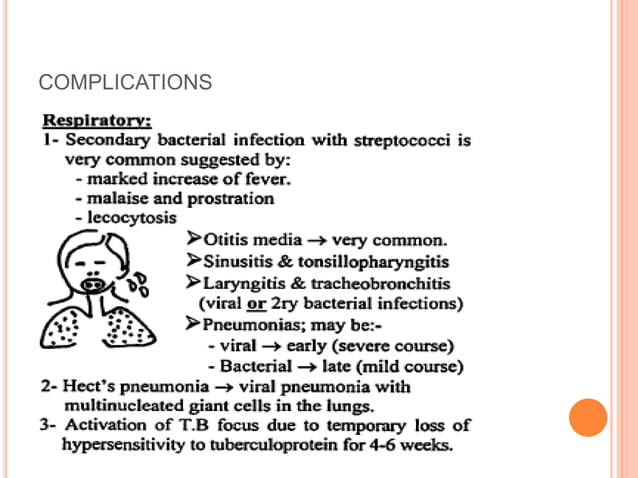 Management of measles. | PPTX | Infectious Diseases | Diseases and ...