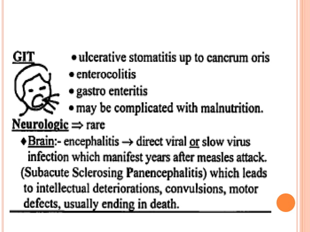 Management of measles. | PPTX | Infectious Diseases | Diseases and ...