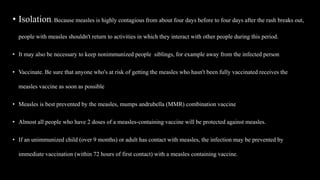 Measles presentation | PPTX