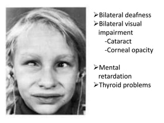 Measles and rubella | PPT