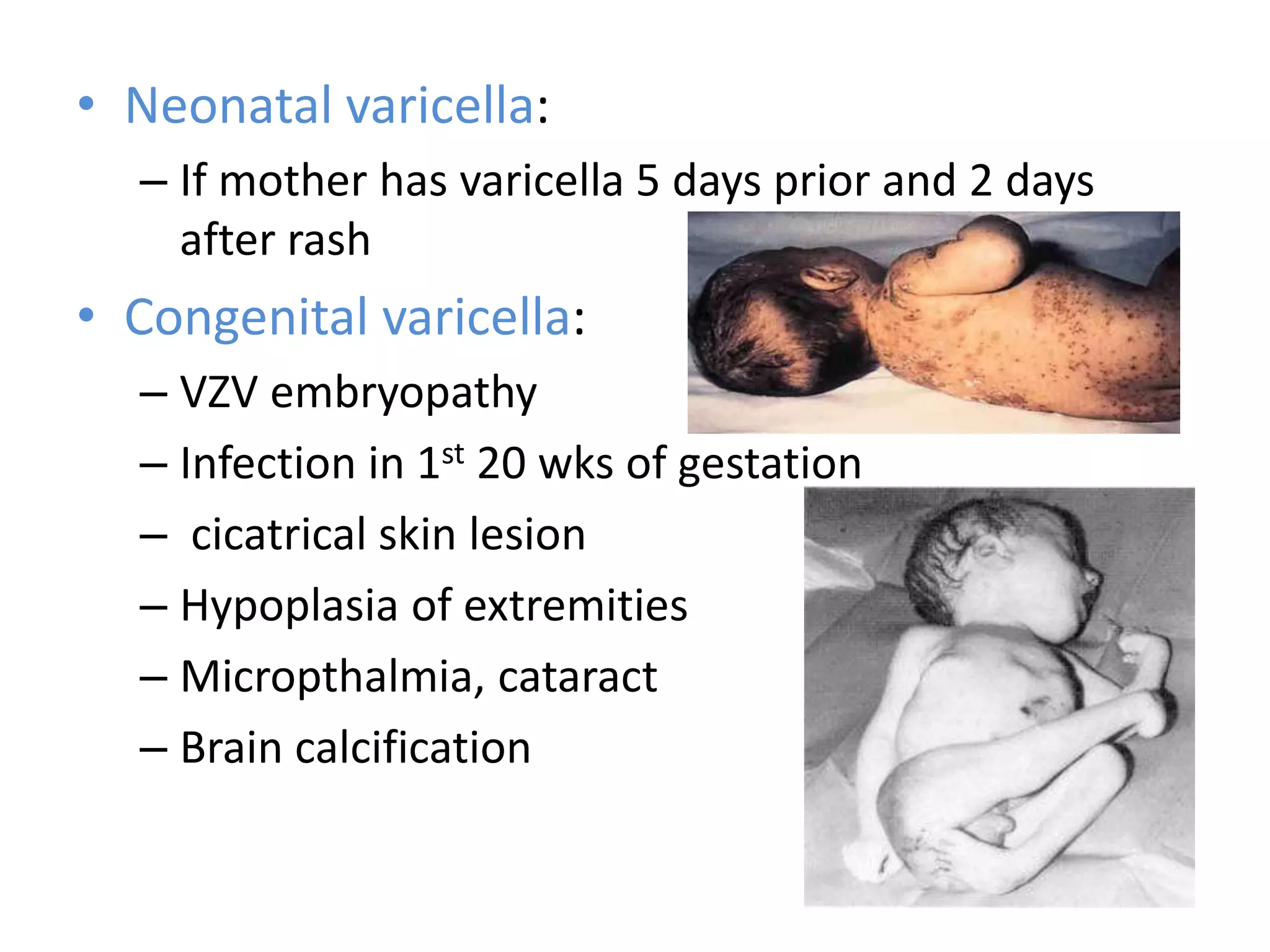 fever with rash in pediatric age groups | PPTX