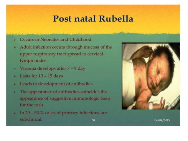 fever with rash in pediatric age groups | PPTX