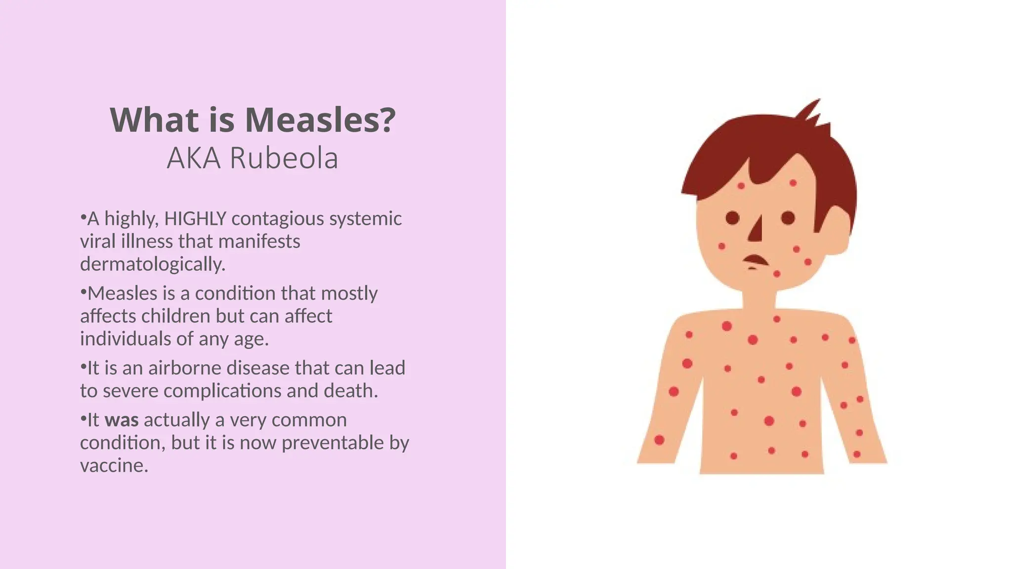 Measles presentation on infectious diseases in paediatric patients | PPTX